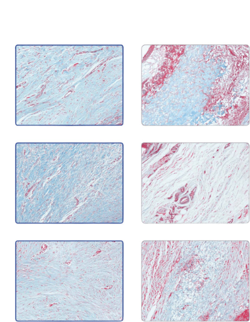 BIOGEN MEDI - OssGuide