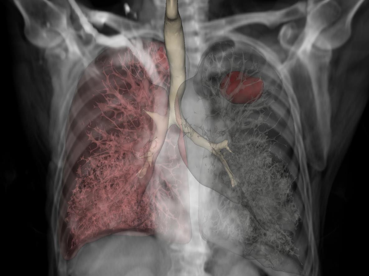Medical Visualisation & Human Anatomy - Glasgow School of Art