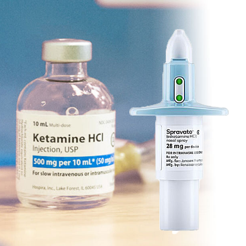Nasal Ketamine (Esketamine) versus IV Ketamine for Treatment-Resistant Depression (TRD)