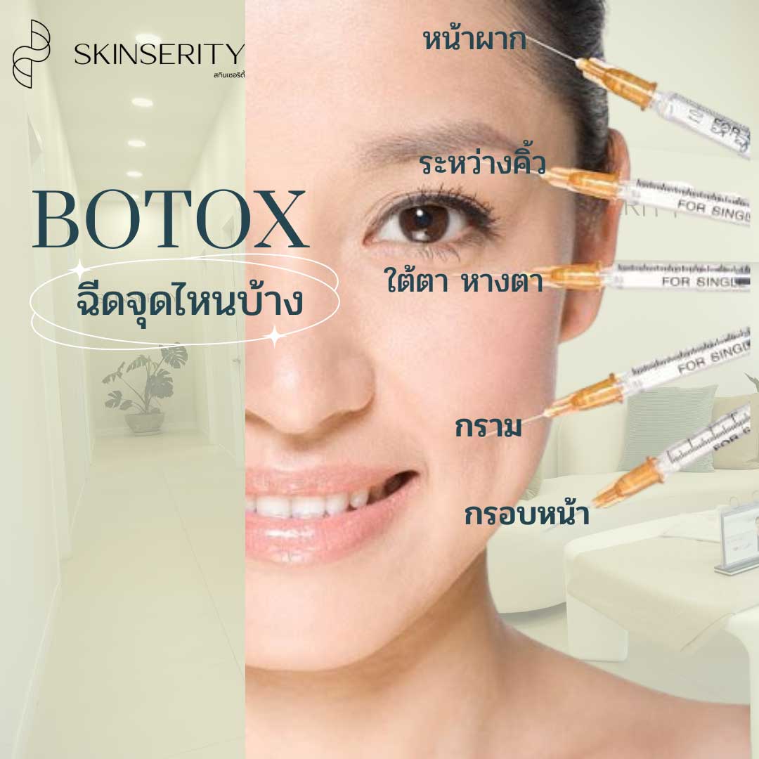 ฉีดโบท็อกซ์ปรับรูปหน้า | Skinserity