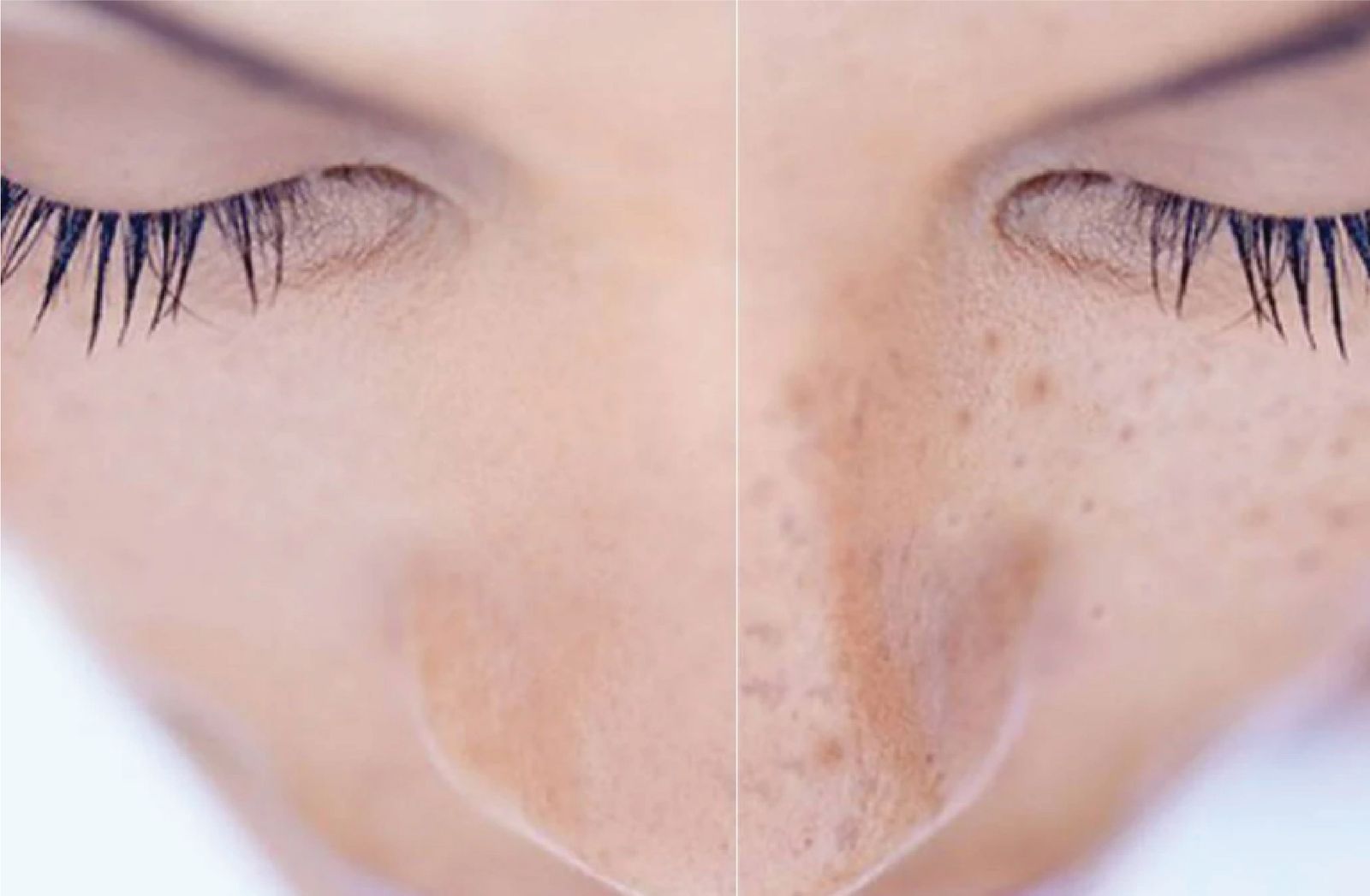 Beauty Aesthetics Med Spa | NEXT HEATLH