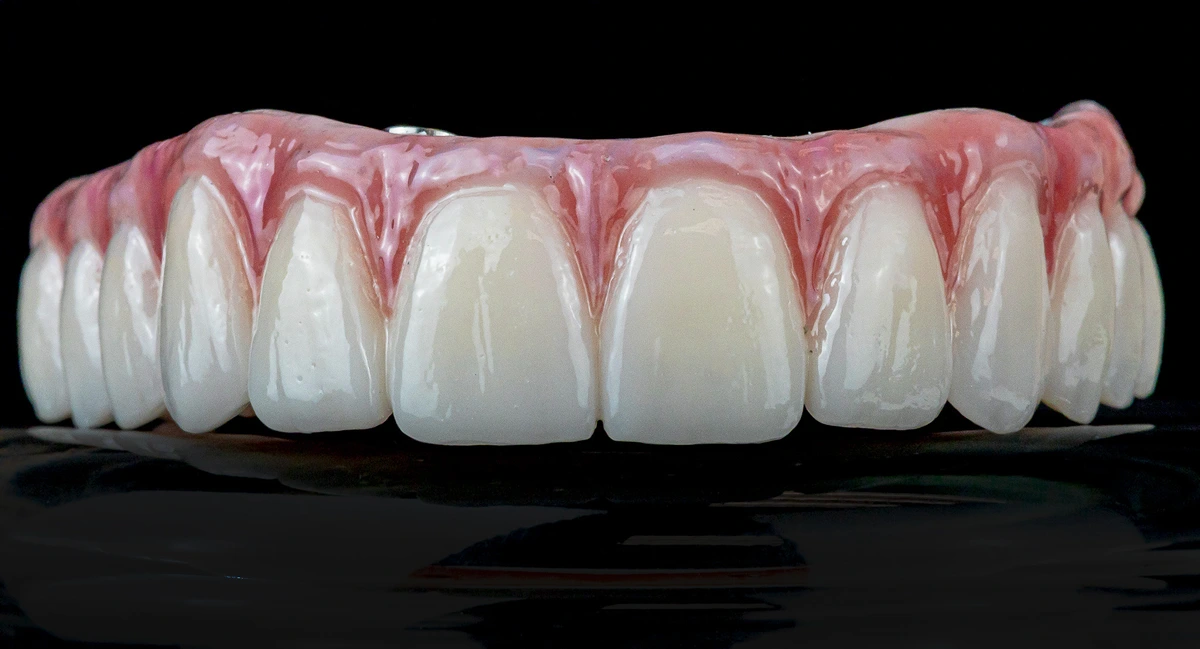 Monolithic Zirconia All-on X | All-on-X | Dani Dental Studio