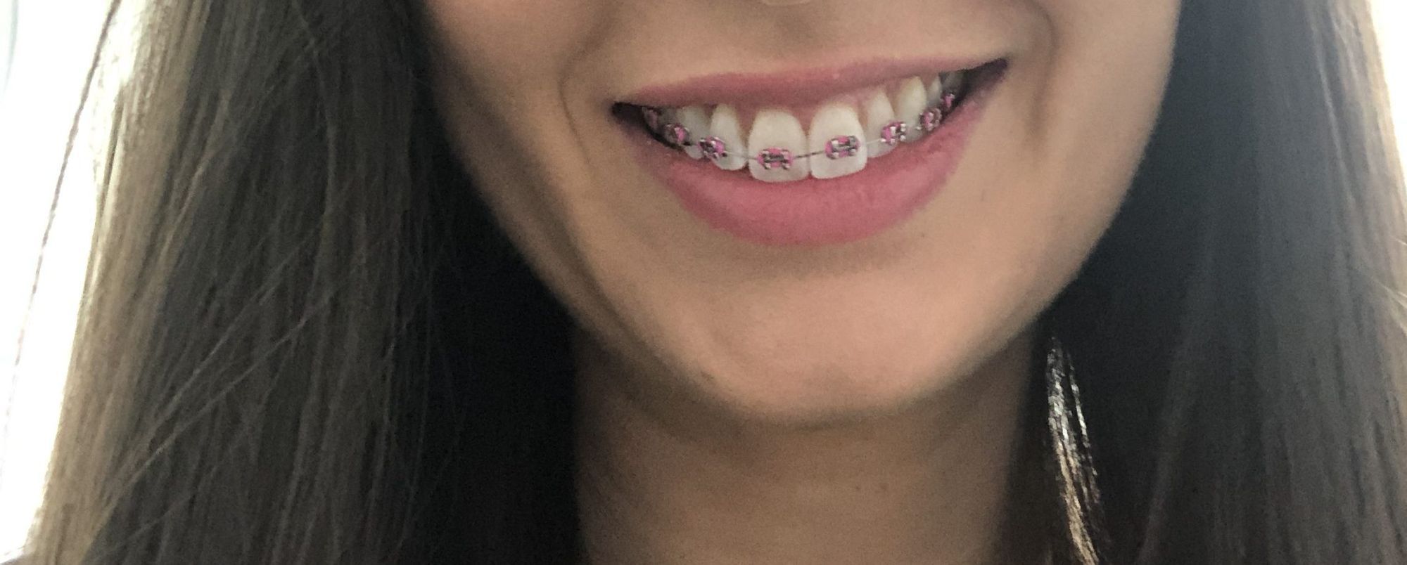 Milngavie Orthodontics