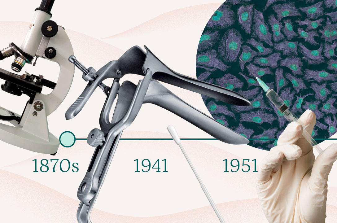 A Brief History of Cervical Cancer Screening