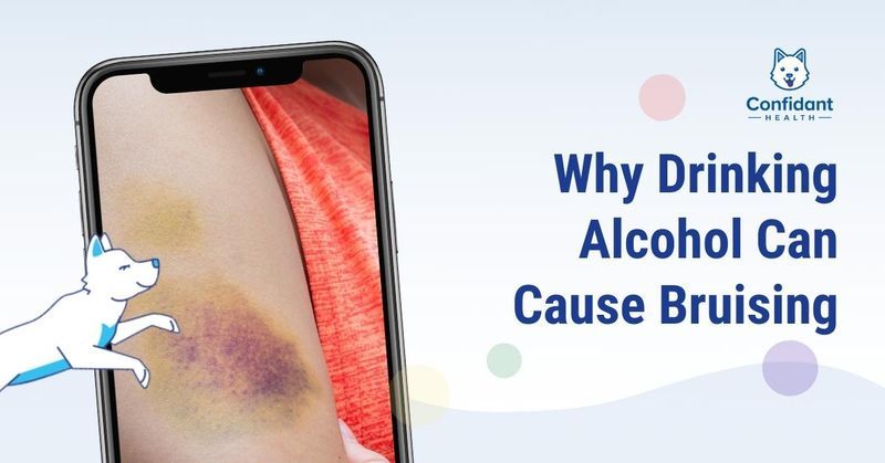 Why Drinking Alcohol Can Cause Bruising