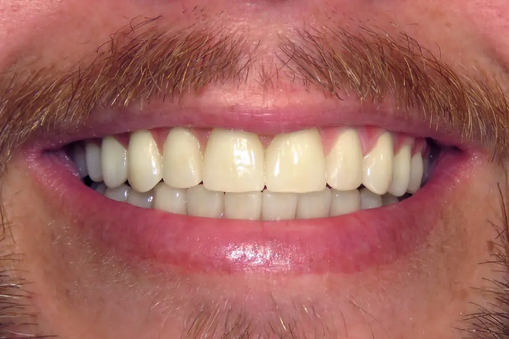 Smile Gallery | Atlanta Dental Spa