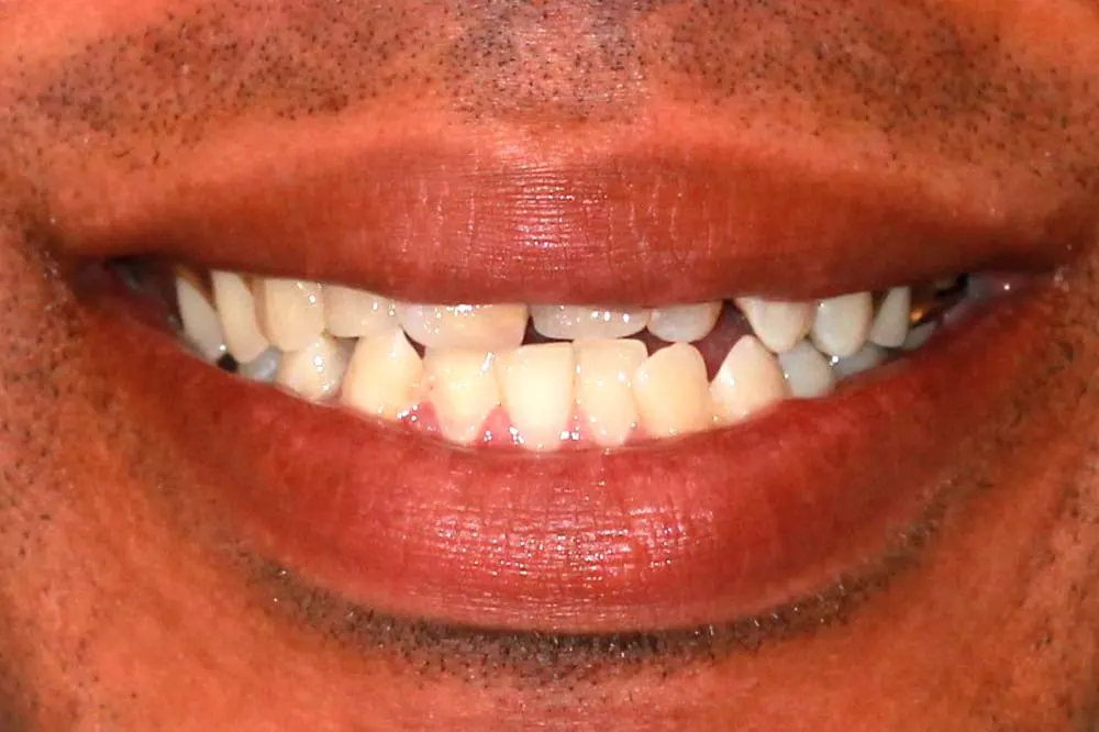 Smile Gallery | Atlanta Dental Spa