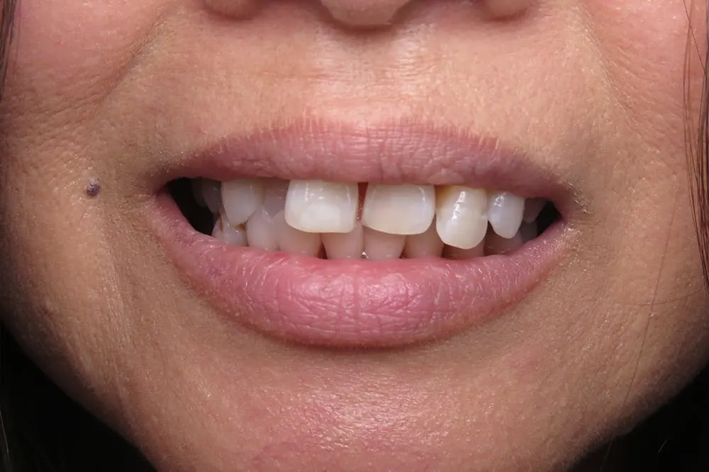 Smile Gallery | Atlanta Dental Spa