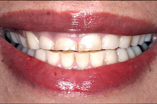 Smile Gallery | Atlanta Dental Spa