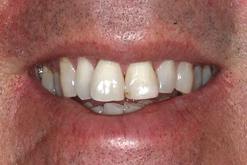 Smile Gallery | Atlanta Dental Spa