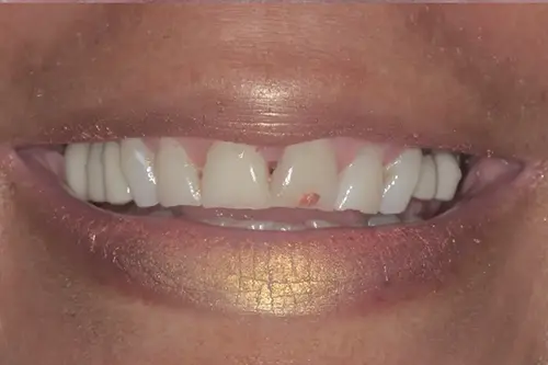 Dentist in Atlanta | Atlanta Dental Spa