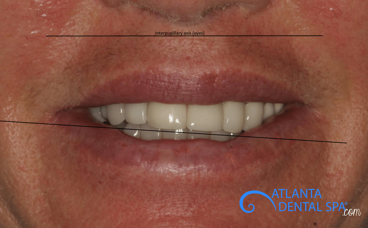 7 Common Problems in Cosmetic Dentistry | Atlanta Dental Spa