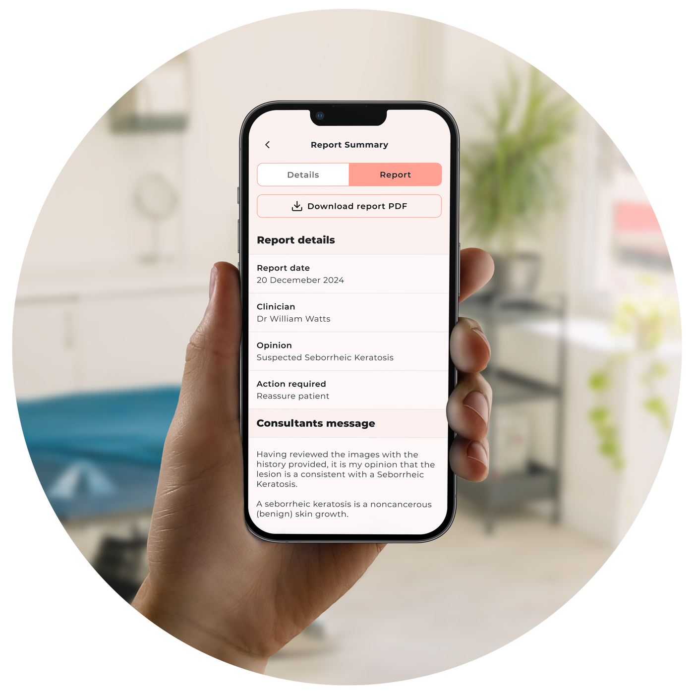 Mole Checks For Clinics