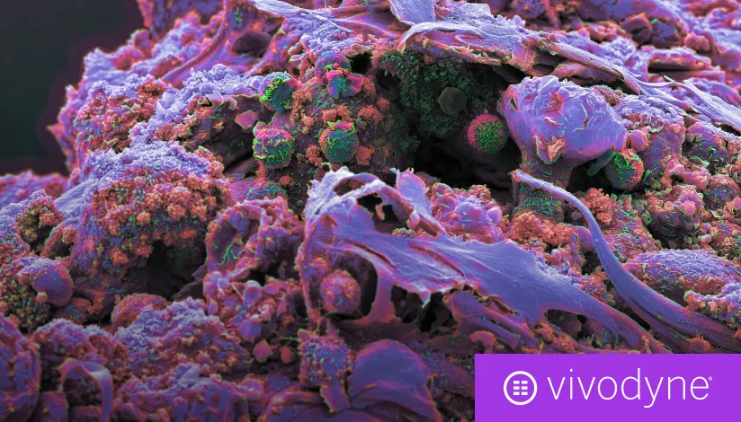 Vivodyne - Our Platform