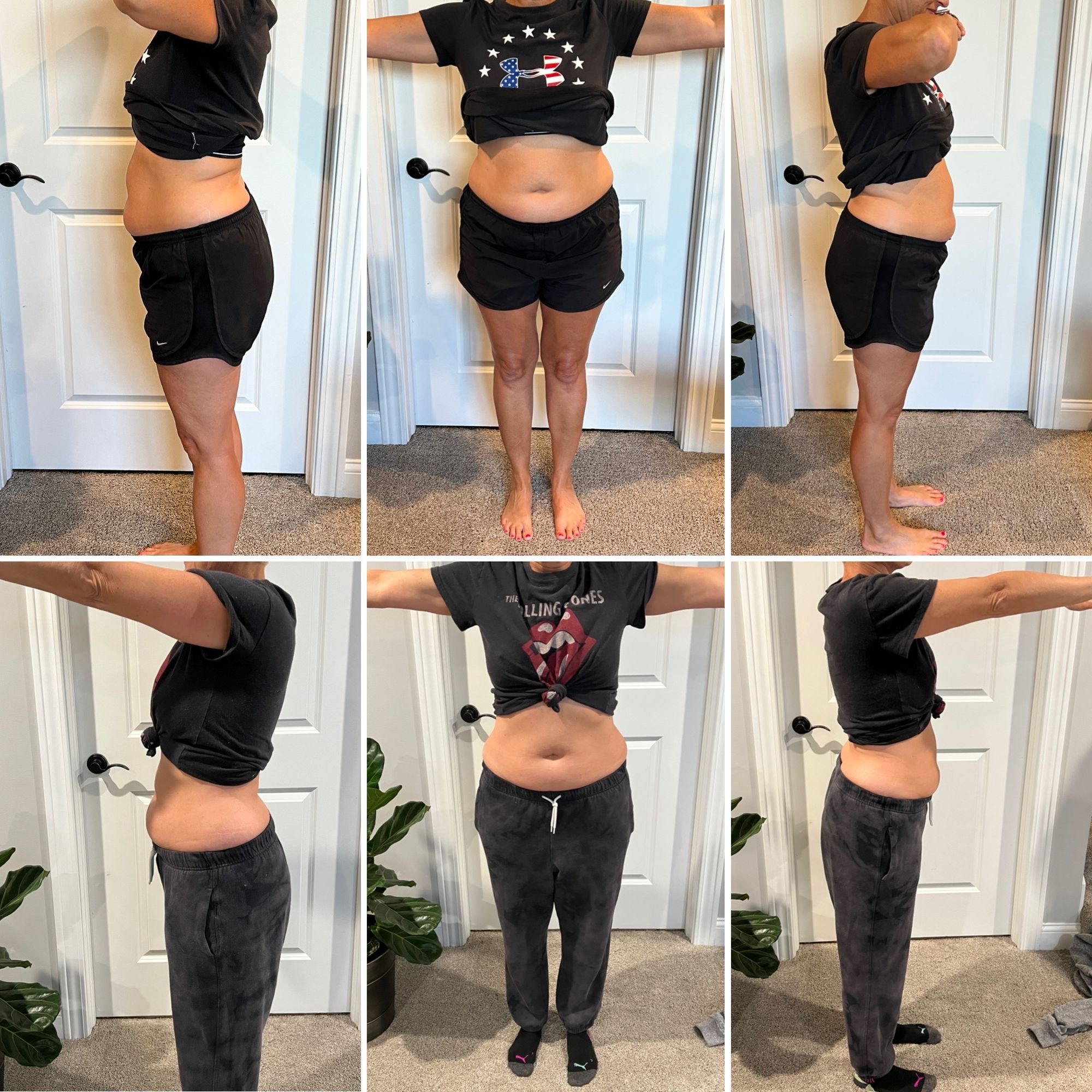 Kaasen Cryosculpting