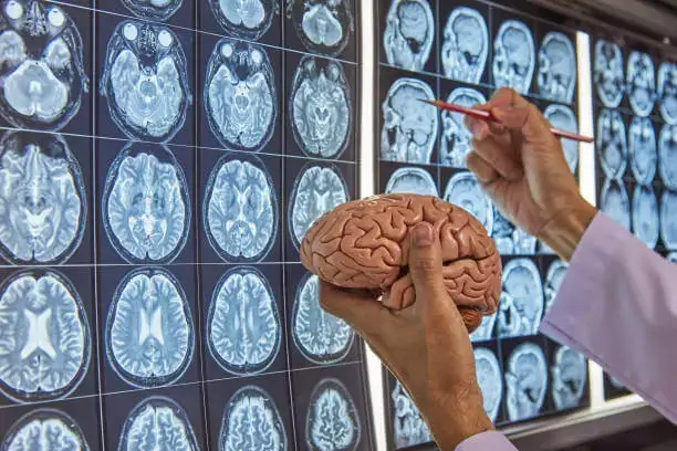 Beyond Anatomy: Exploring 3D Printed Medical Models for Neurosurgery