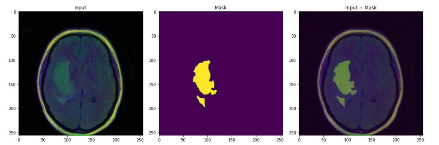 How to identify ROI using Machine Learning
