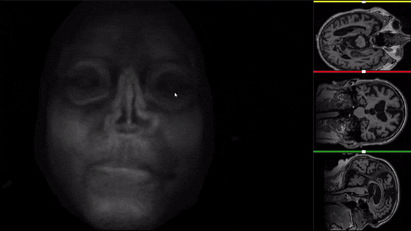 Inside the Brain: A Step-by-Step Journey for Crafting an Alzheimer’s ...