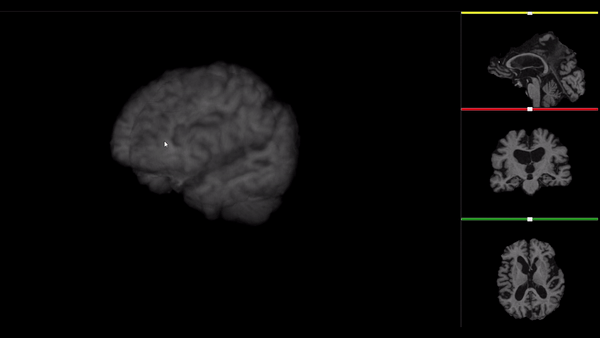 Inside the Brain: A Step-by-Step Journey for Crafting an Alzheimer’s ...