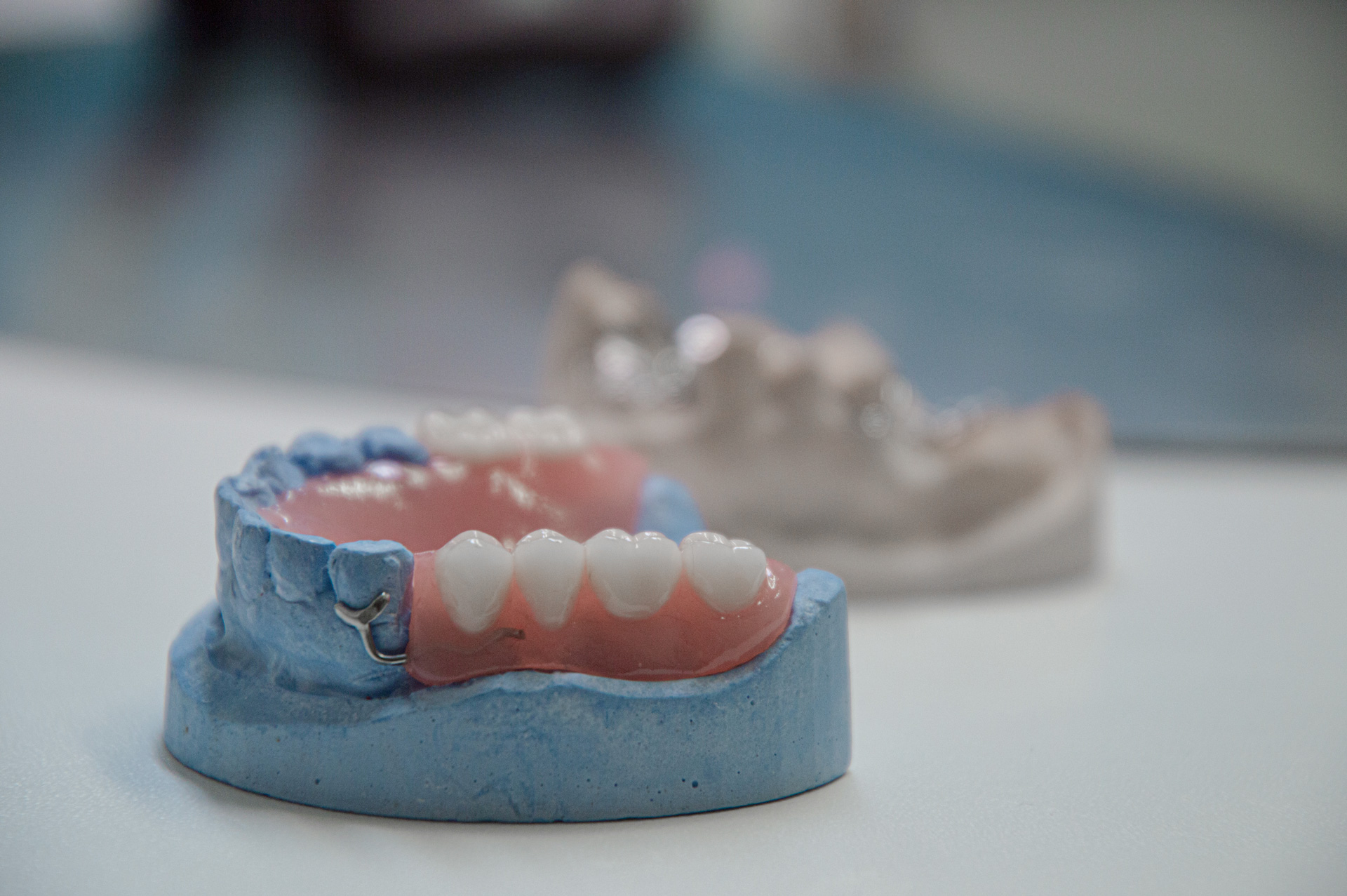 Corbin Elen I Flexibele protheses Valplast I Pelt