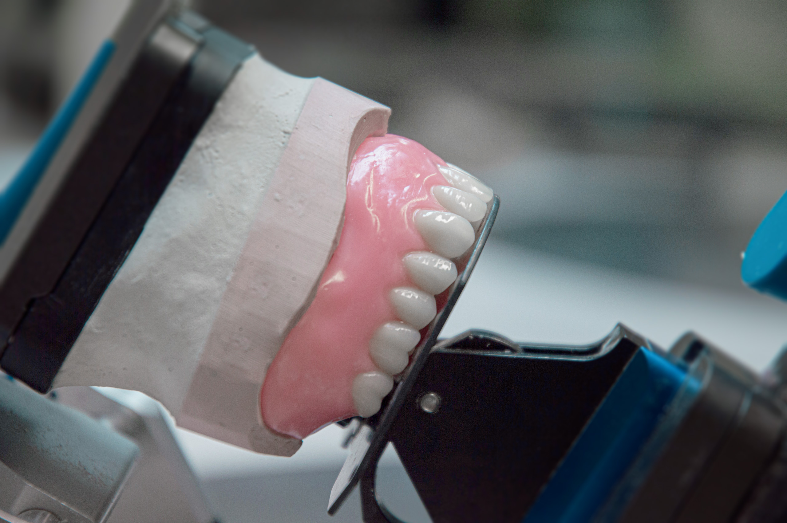 Corbin Elen I Tandtechnicus in Pelt I Realisaties