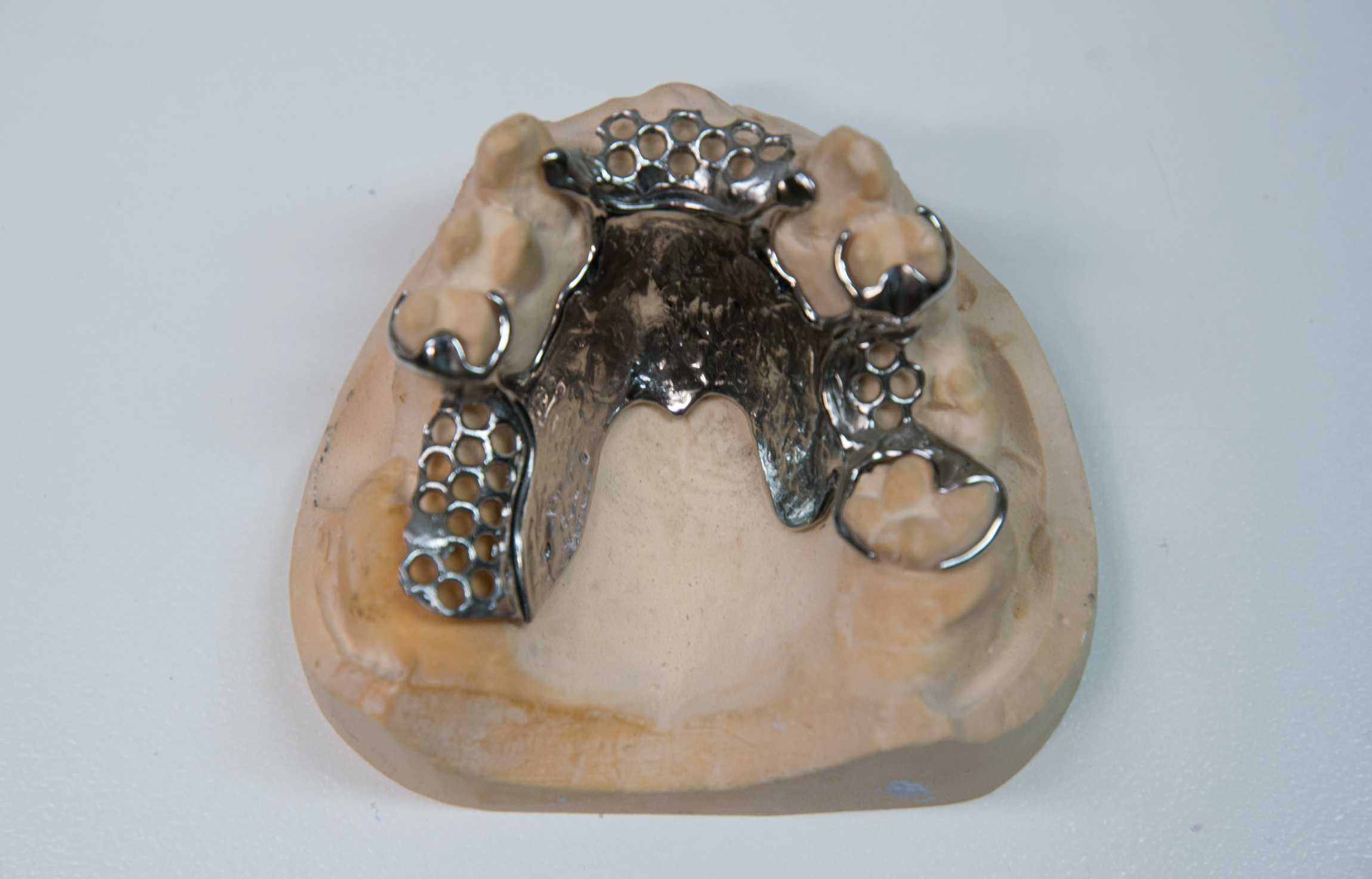 Corbin Elen I Frameprotheses I Pelt I Alternatief vals gebit