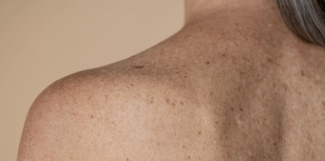 Re.think skin