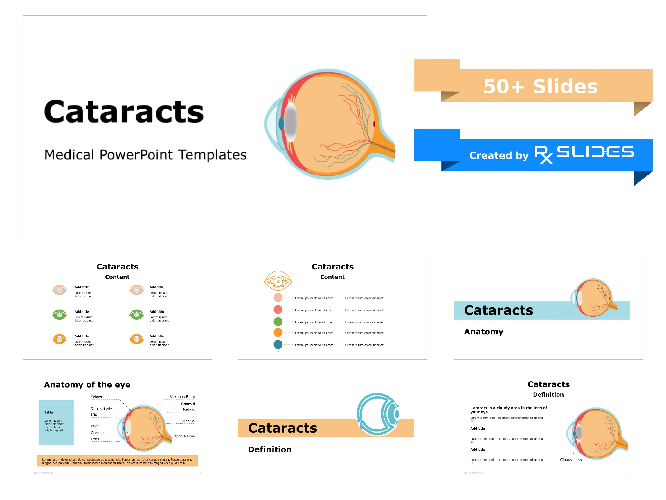 Download Cataracts PowerPoint Template|