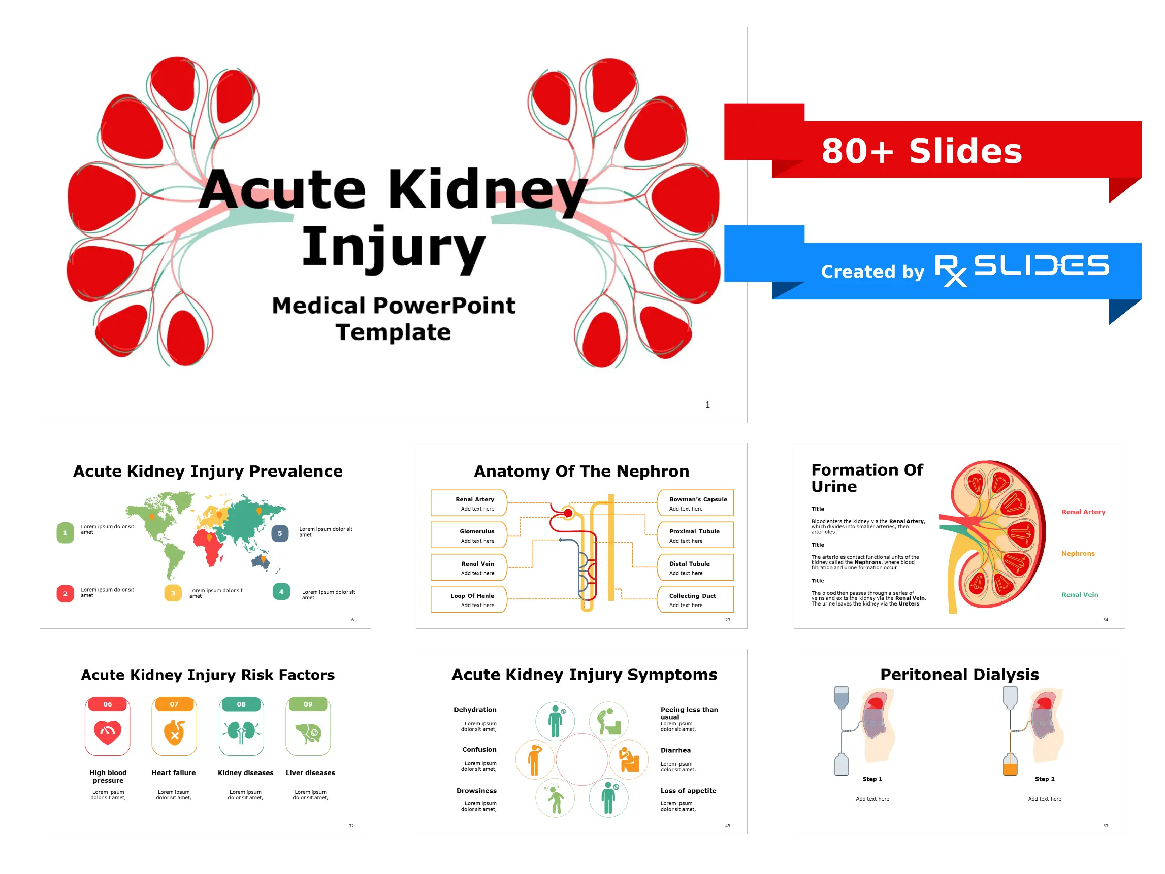 Download Acute kidney injury PowerPoint Template| RxSlides