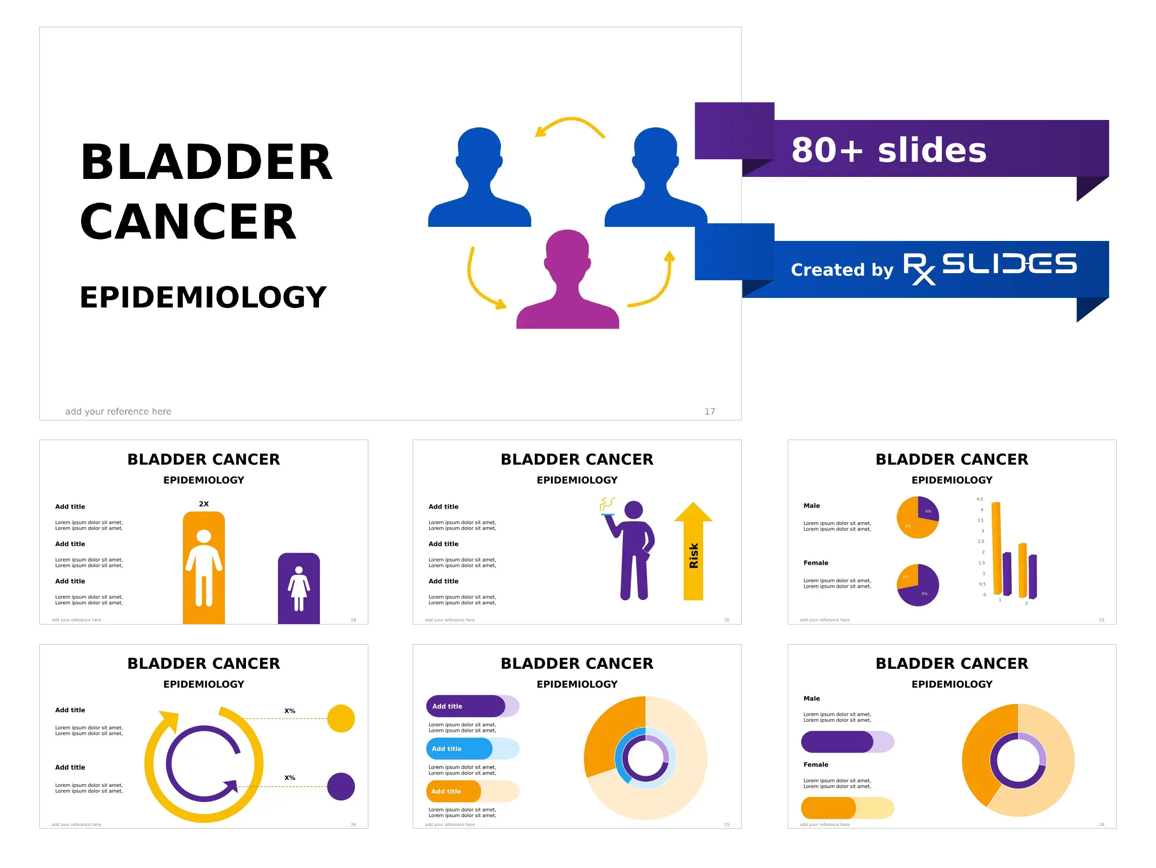 Download Bladder Cancer PowerPoint Template|RxSlides