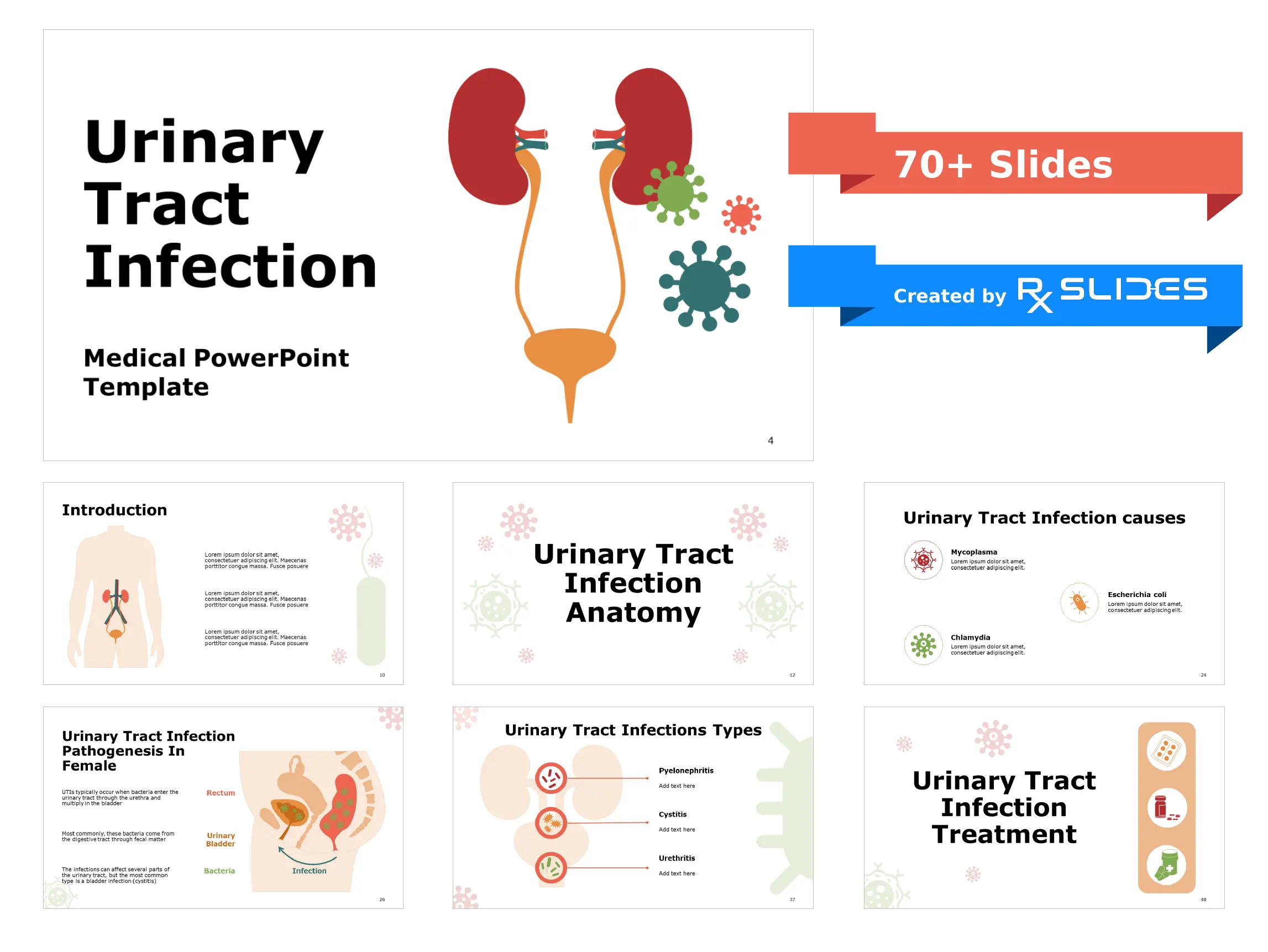 Download Urinary Tract Infections PowerPoint Template| RxSlides