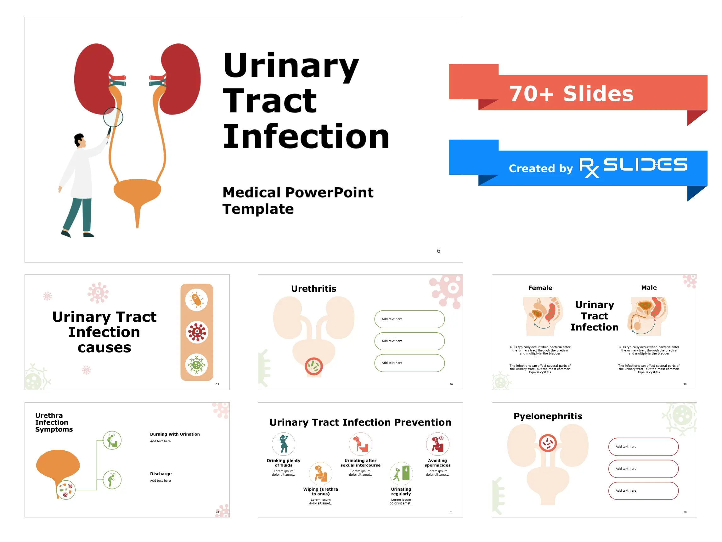 Download Urinary Tract Infections PowerPoint Template| RxSlides