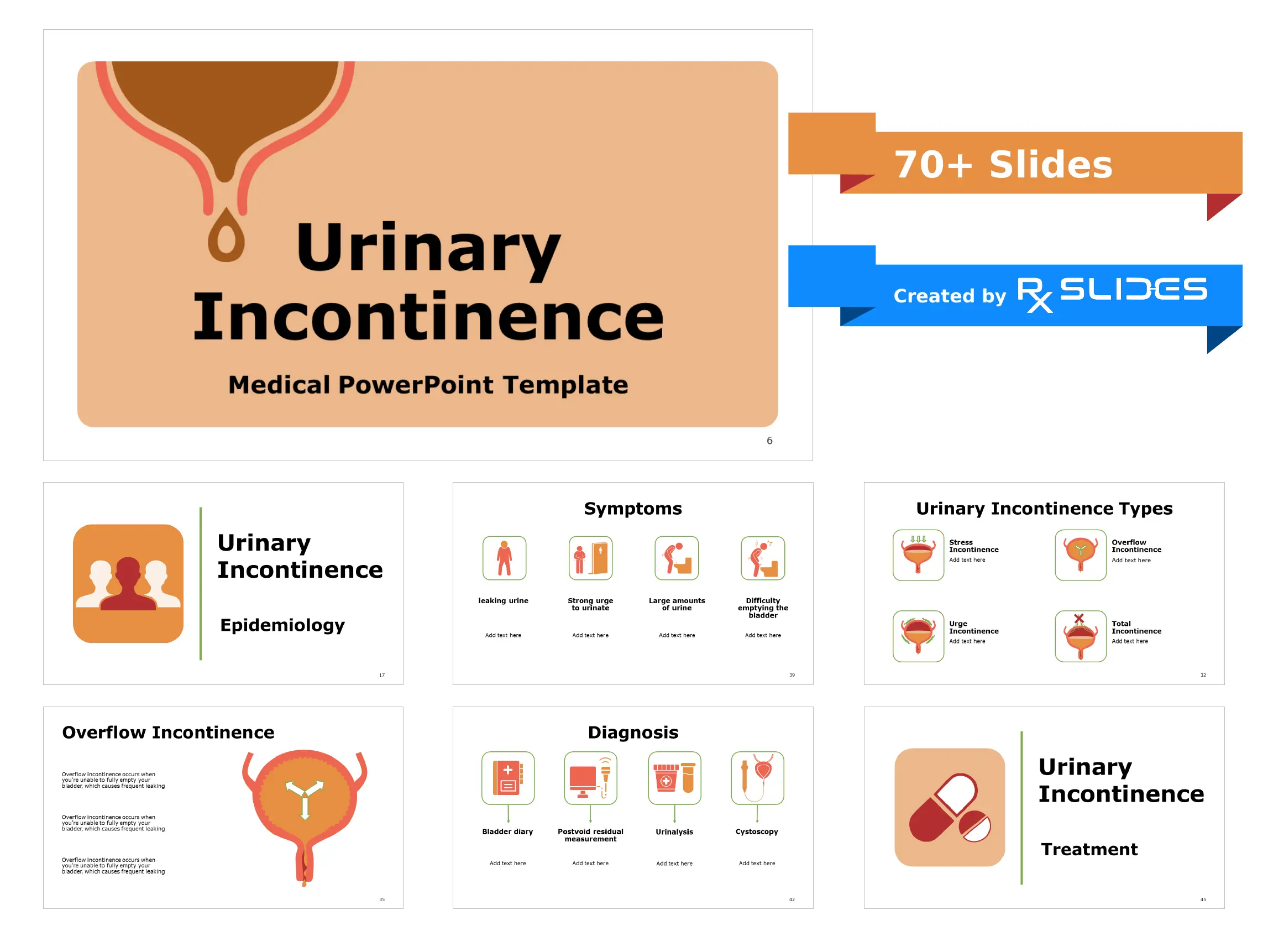 Download Urinary Incontinence PowerPoint Template| RxSlides