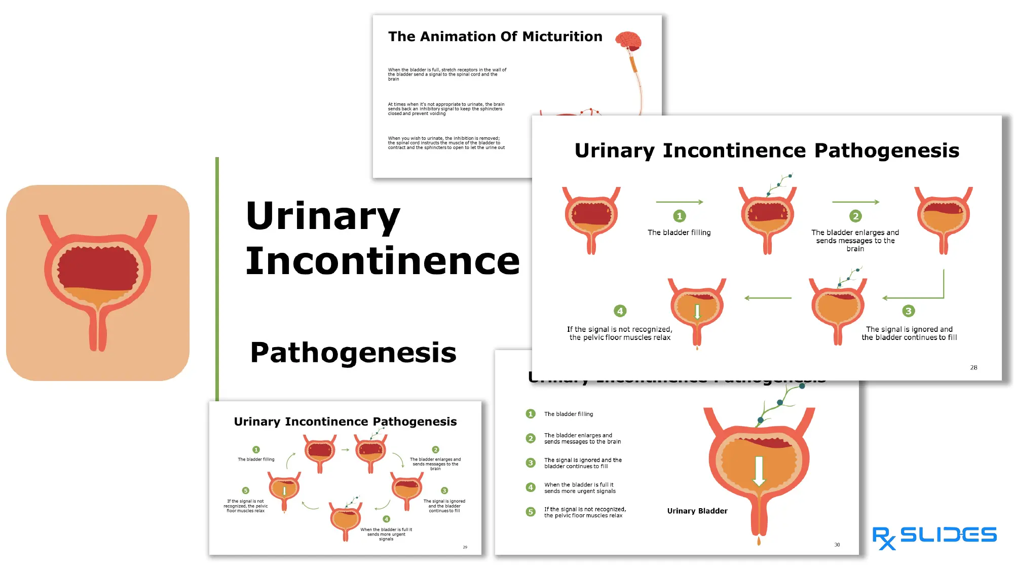 Download Urinary Incontinence PowerPoint Template| RxSlides