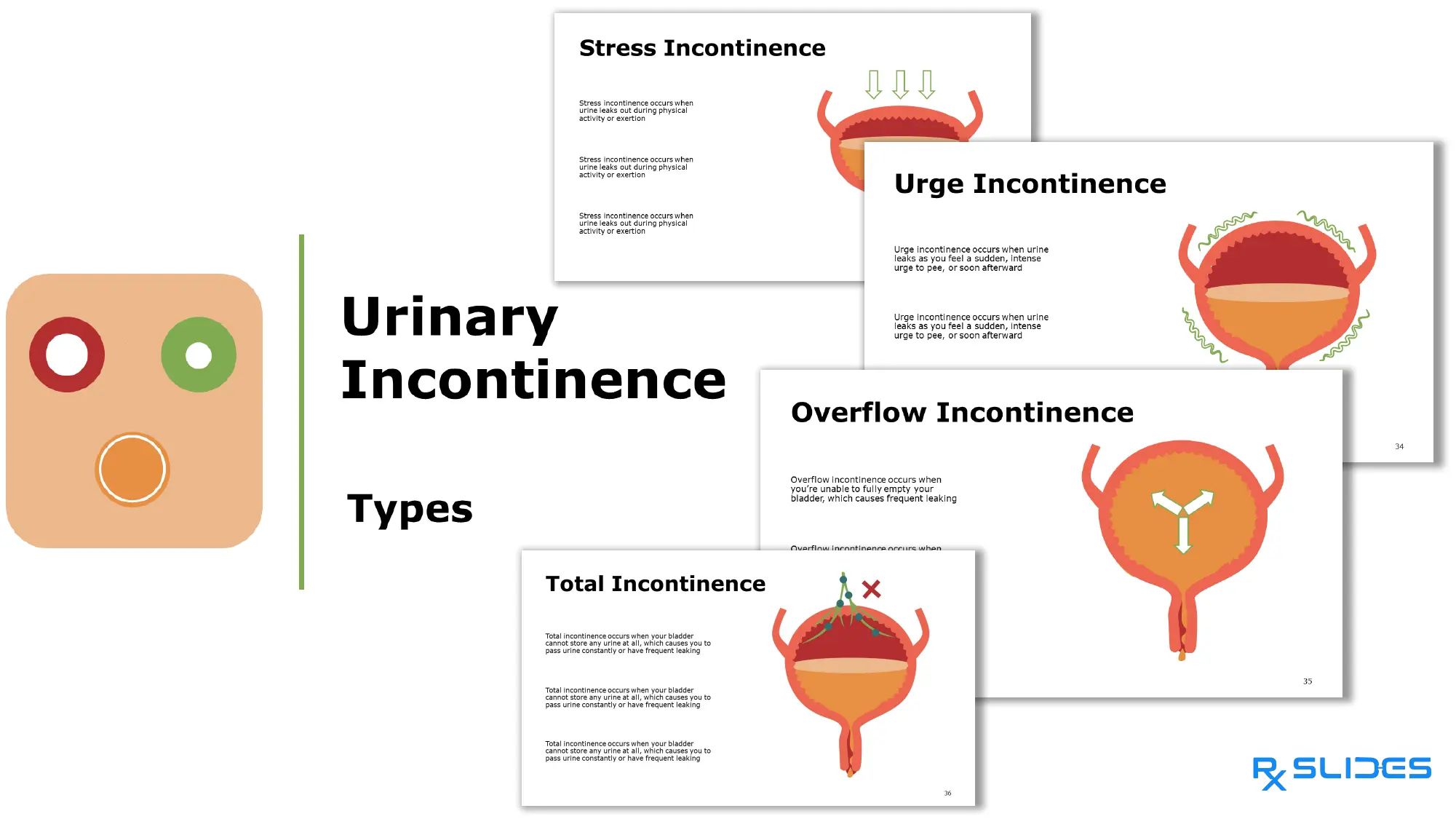 Download Urinary Incontinence PowerPoint Template| RxSlides