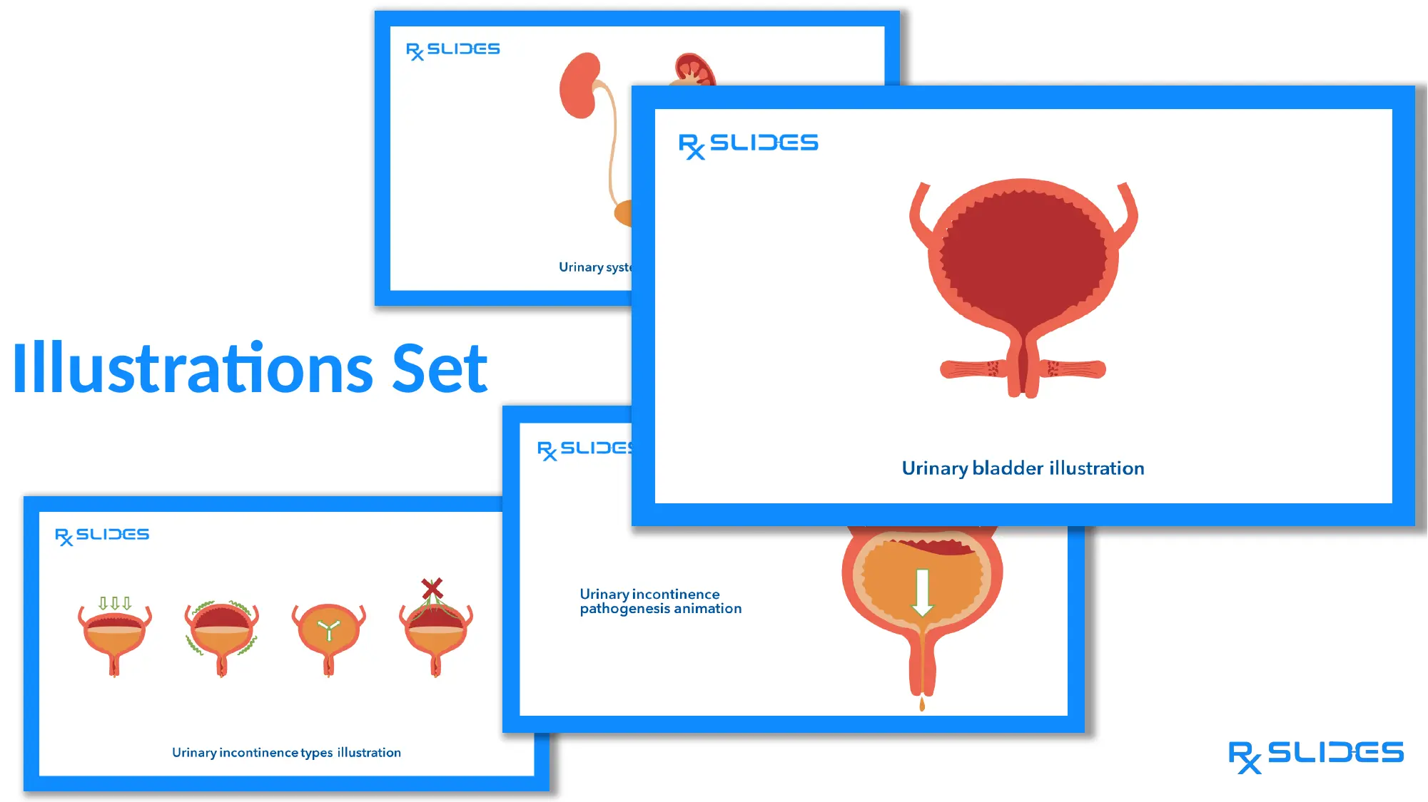 Download Urinary Incontinence PowerPoint Template| RxSlides