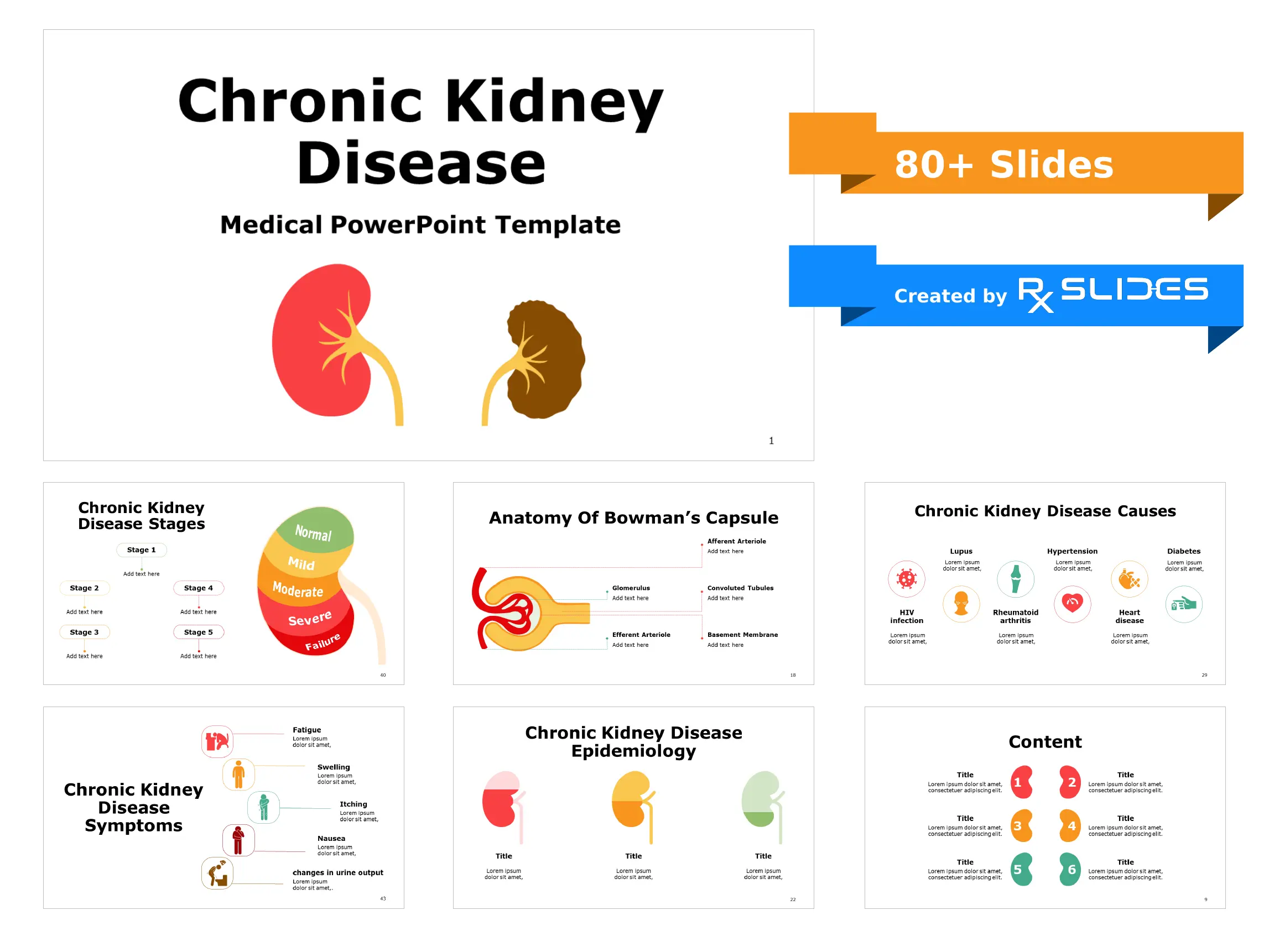 Download Chronic kidney Disease PowerPoint Template|RxSlides