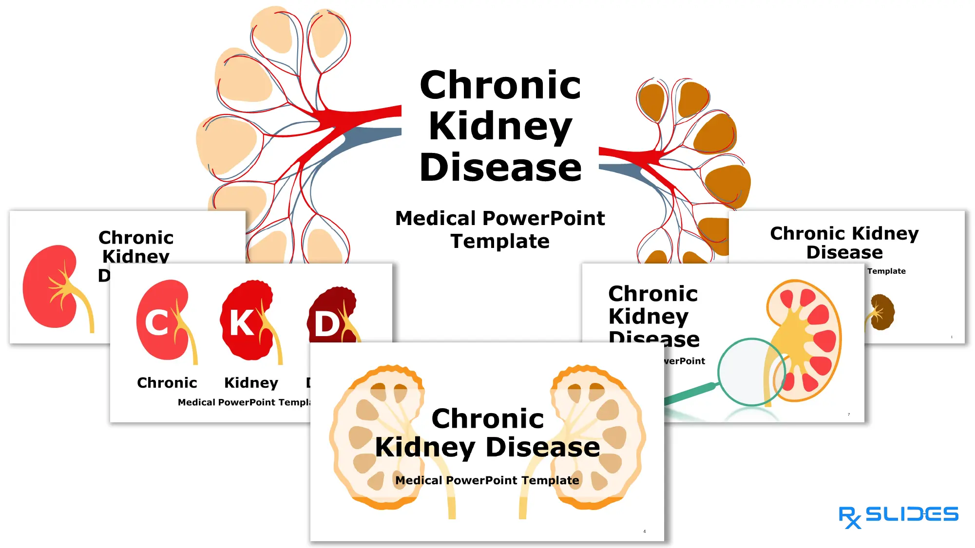Download Chronic kidney Disease PowerPoint Template|RxSlides