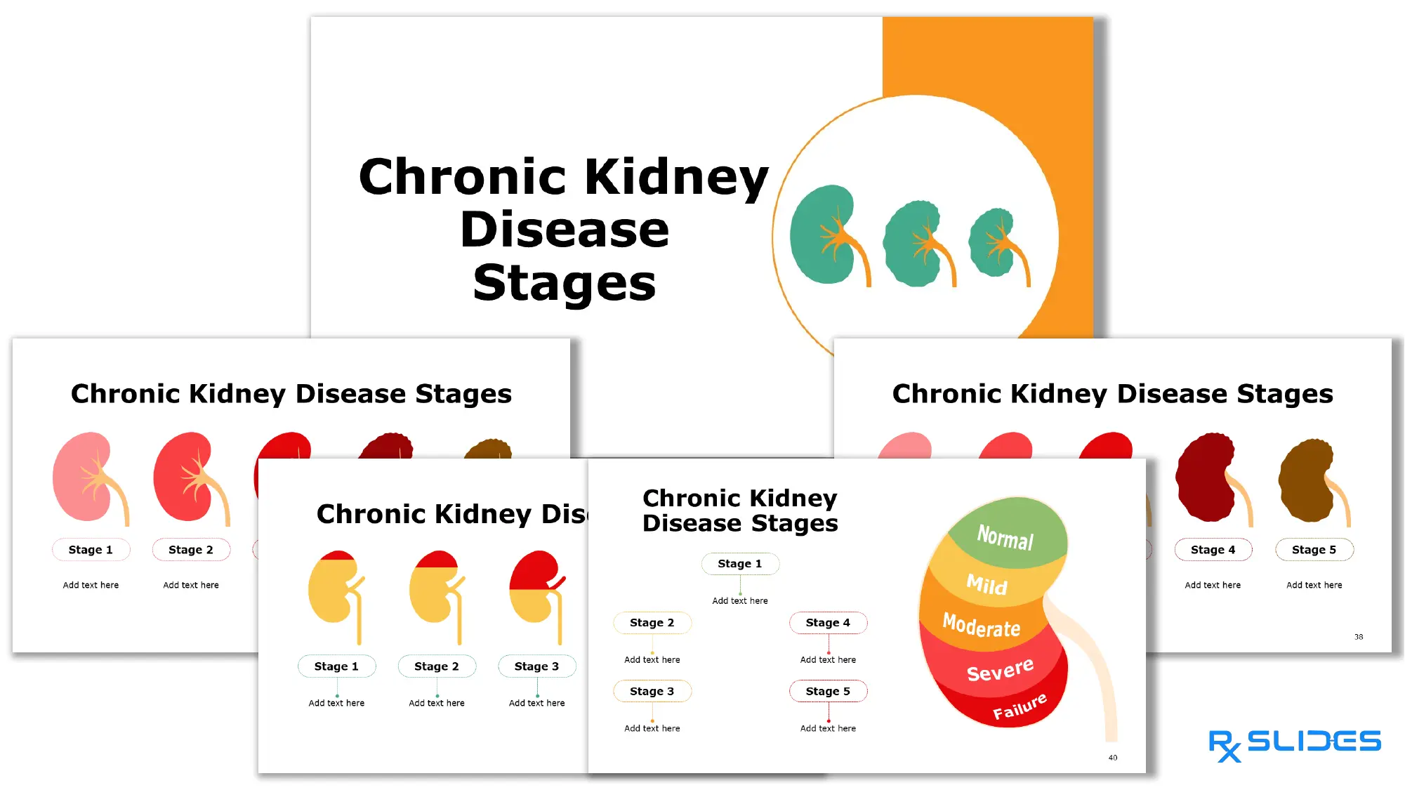 Download Chronic kidney Disease PowerPoint Template|RxSlides