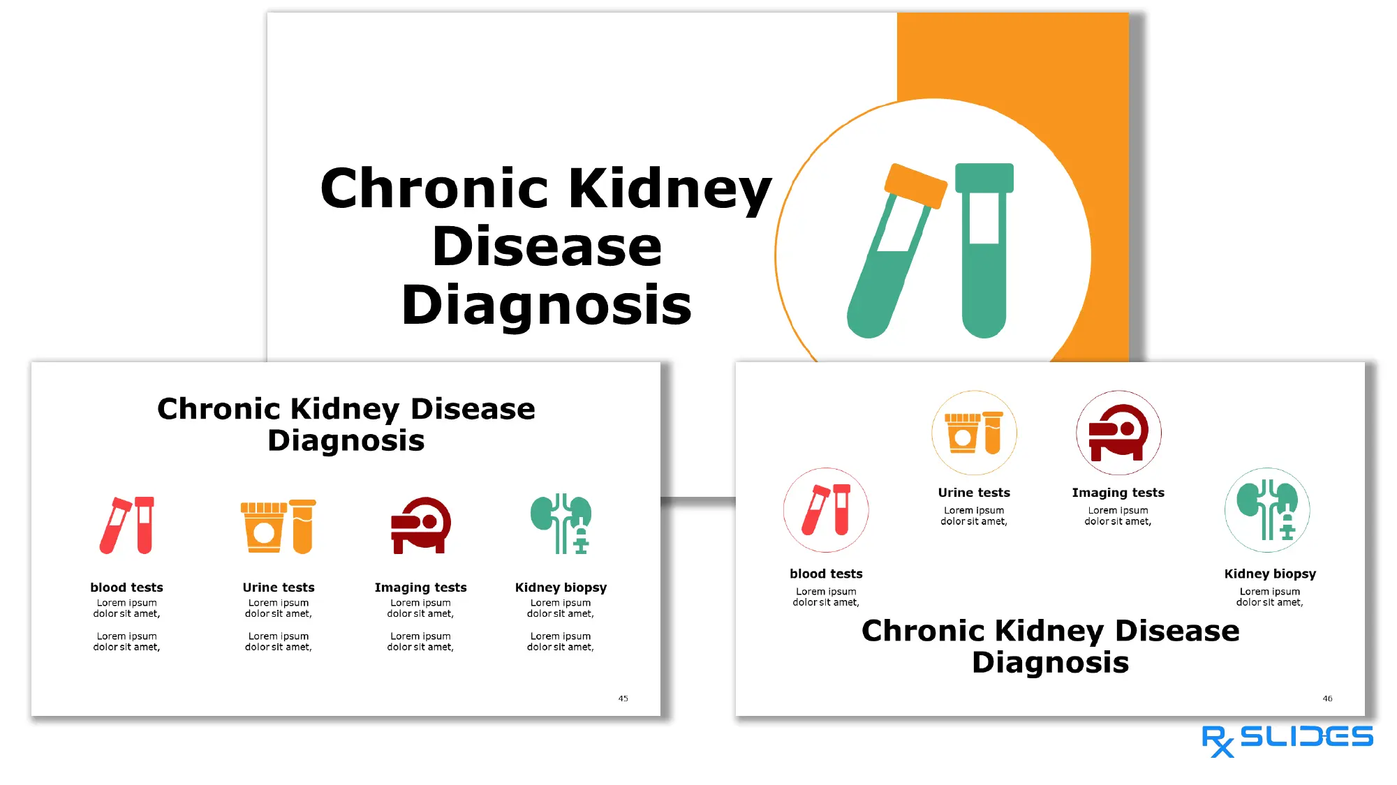 Download Chronic kidney Disease PowerPoint Template| RxSlides