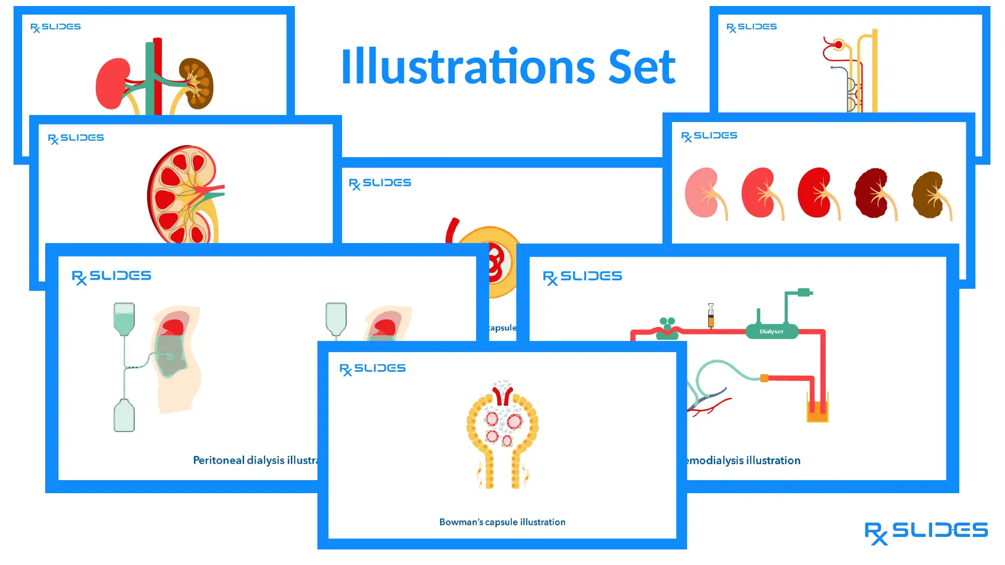 Download Chronic kidney Disease PowerPoint Template|RxSlides