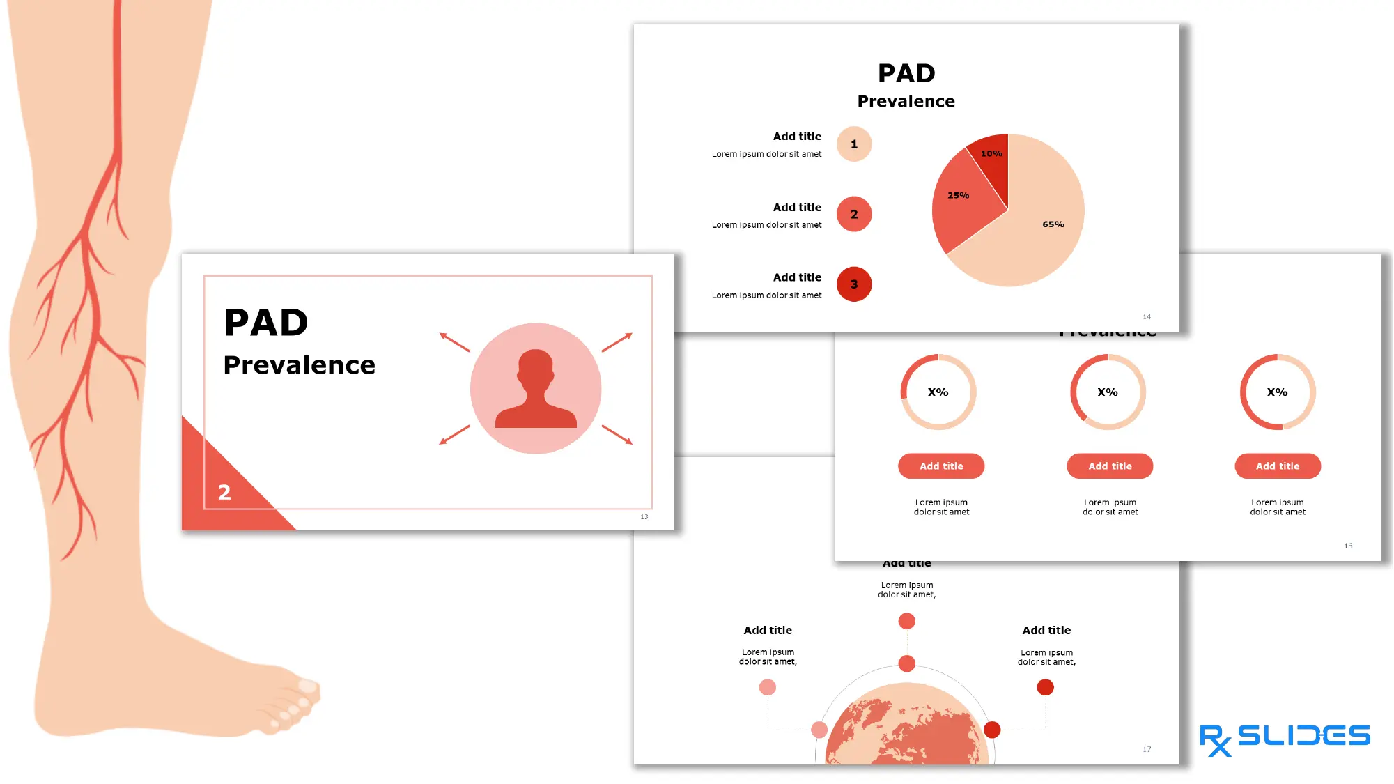Download Peripheral Arterial Disease PowerPoint Template| RxSlides
