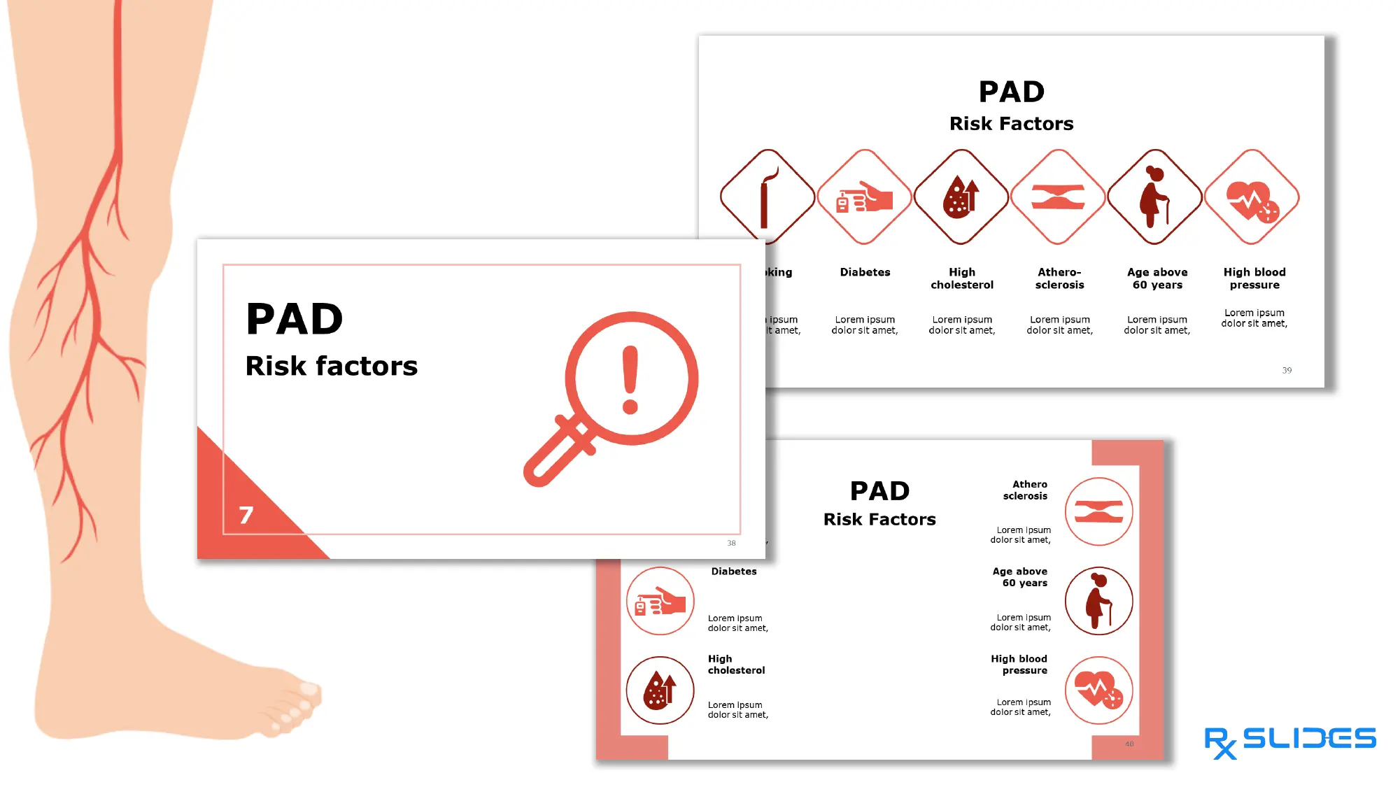 Download Peripheral Arterial Disease PowerPoint Template| RxSlides