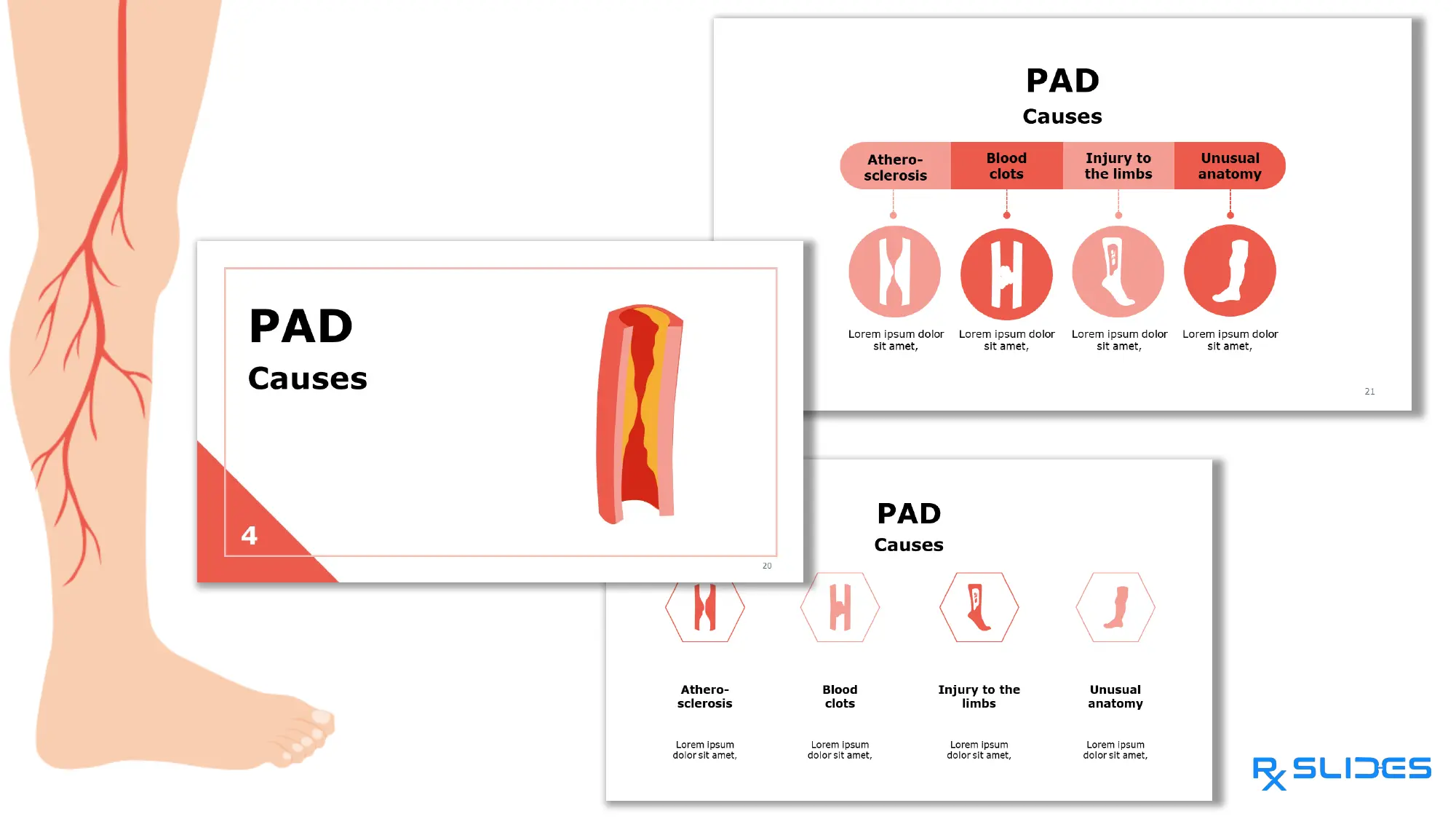 Download Peripheral Arterial Disease PowerPoint Template| RxSlides