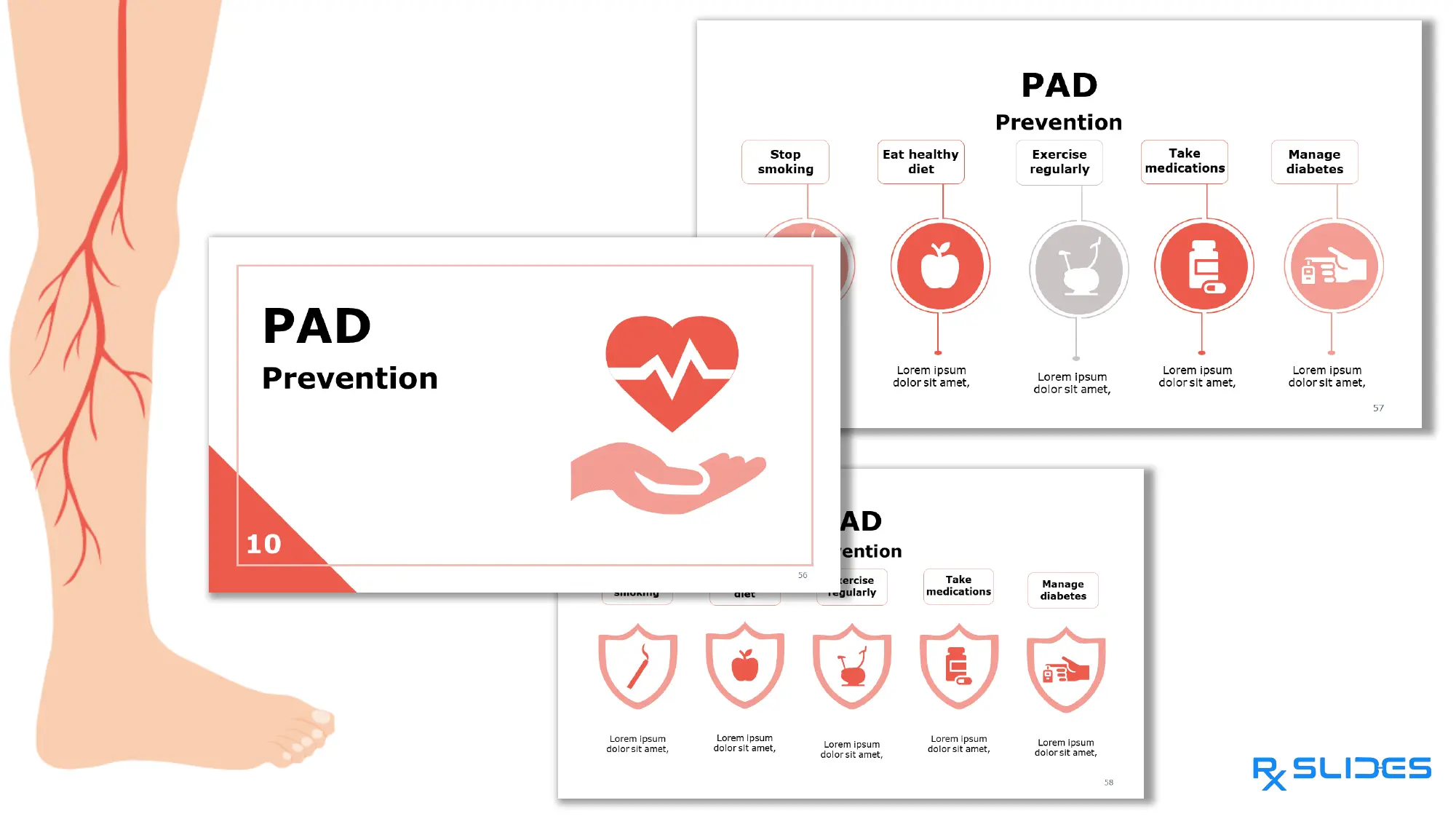 Download Peripheral Arterial Disease PowerPoint Template| RxSlides