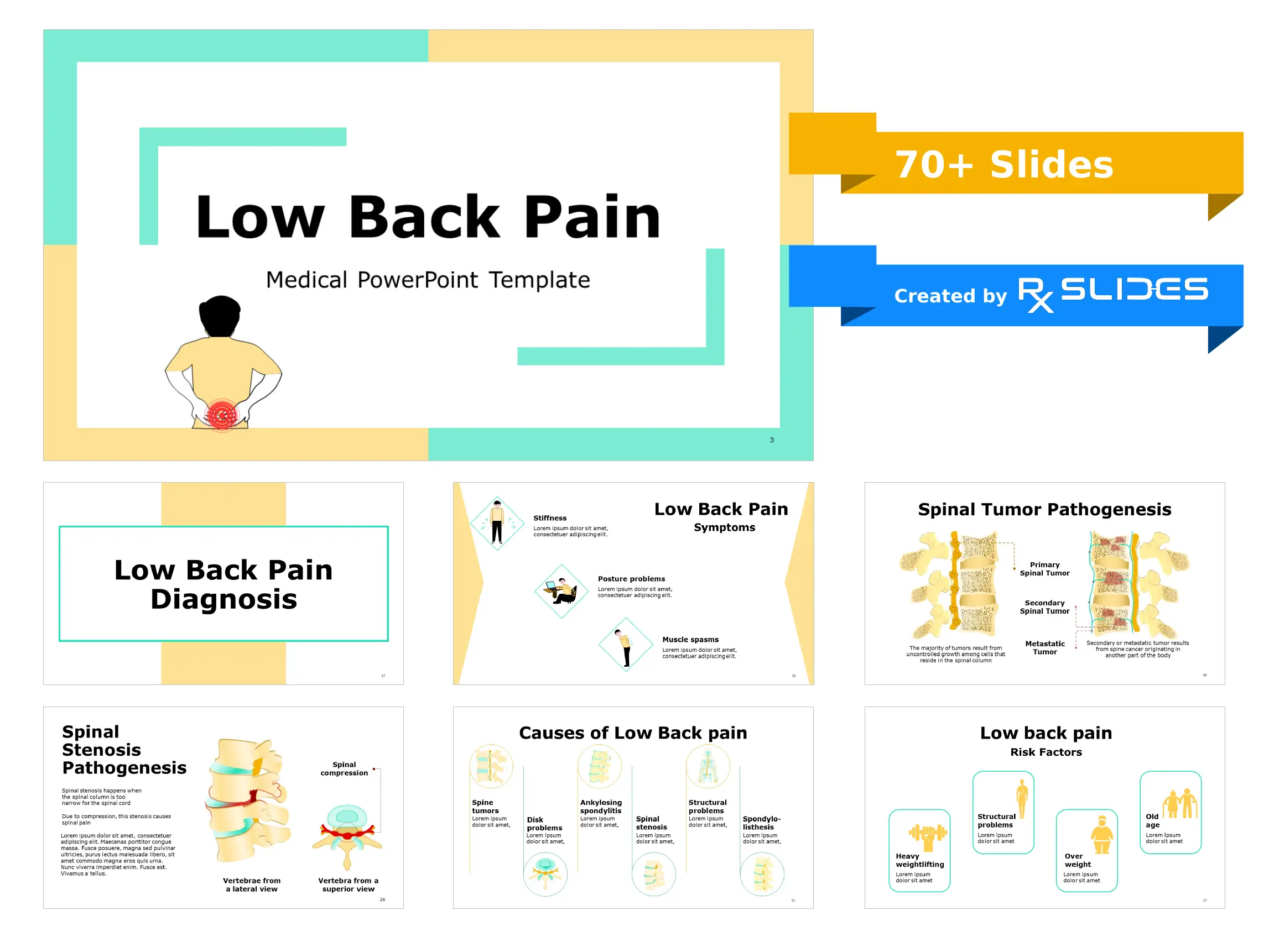 Download Low Back Pain PowerPoint Template|RxSlides