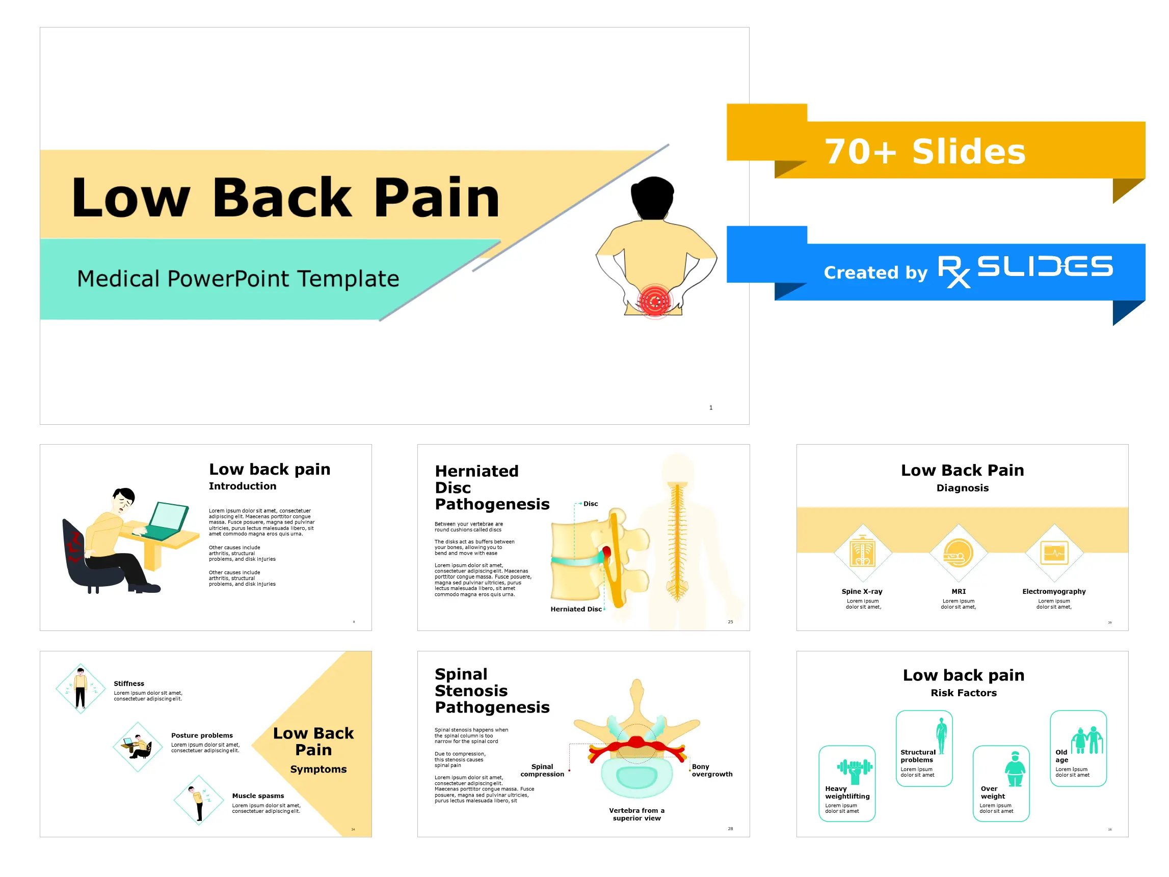 Download Low Back Pain PowerPoint Template|RxSlides