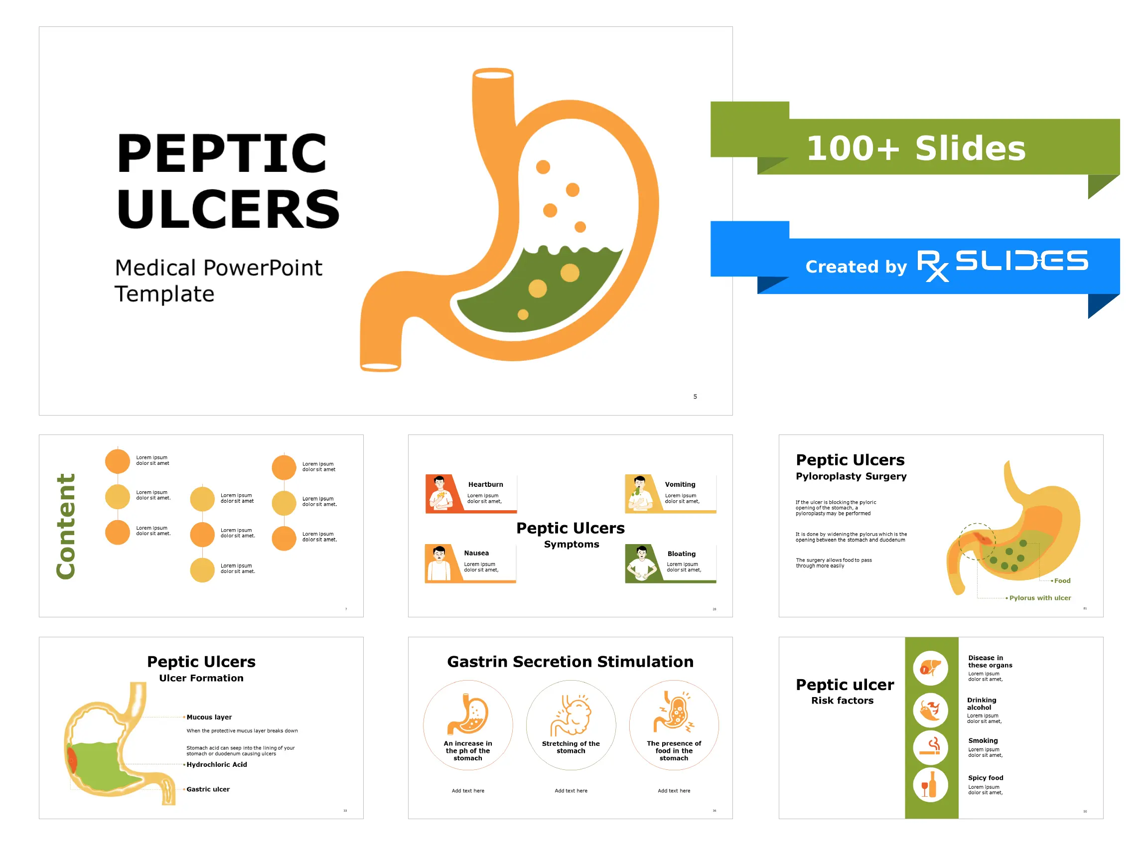Download Peptic Ulcer Disease PowerPoint Template| RxSlides