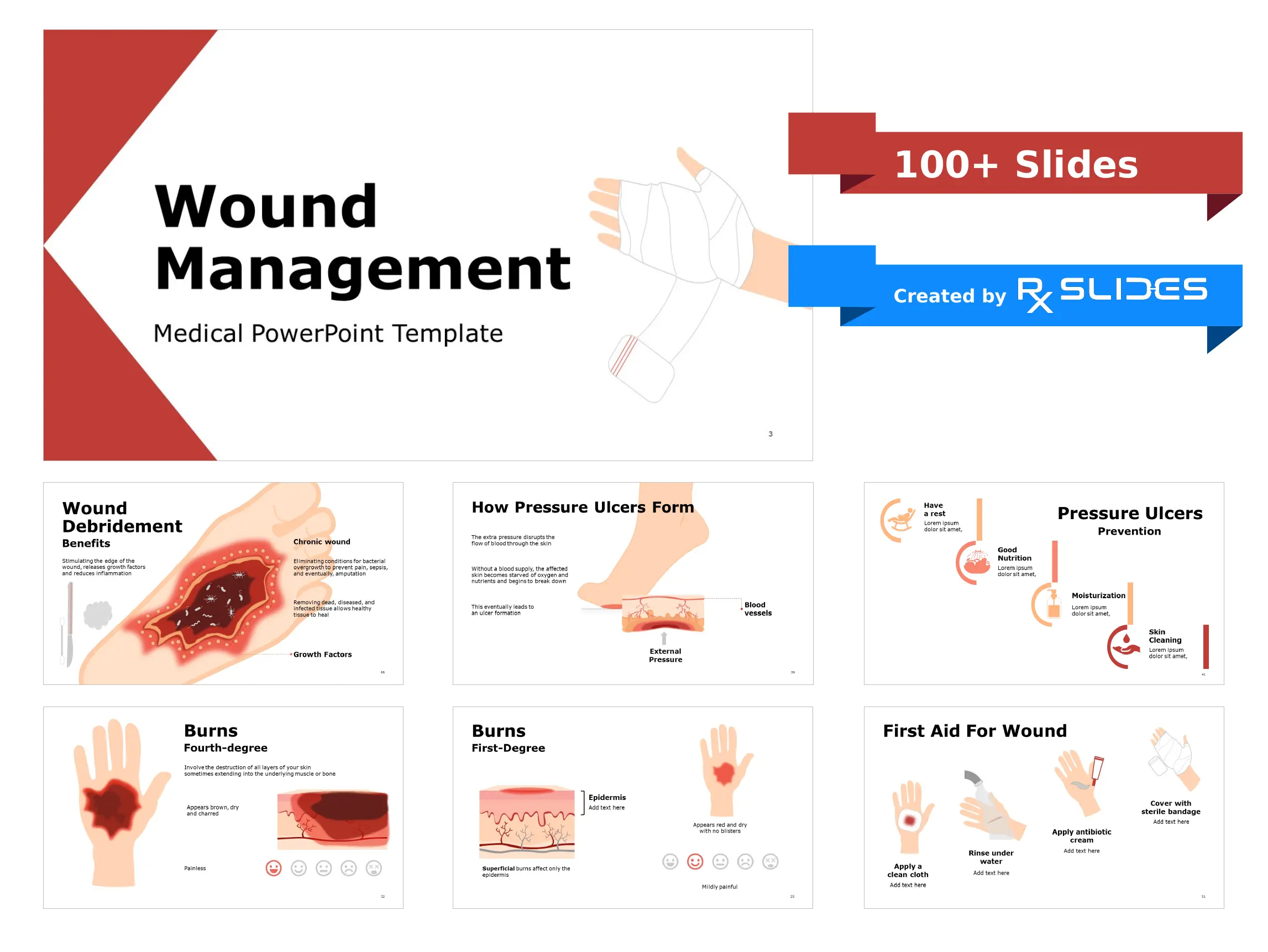 Download Wound Management PowerPoint Template| RxSlides