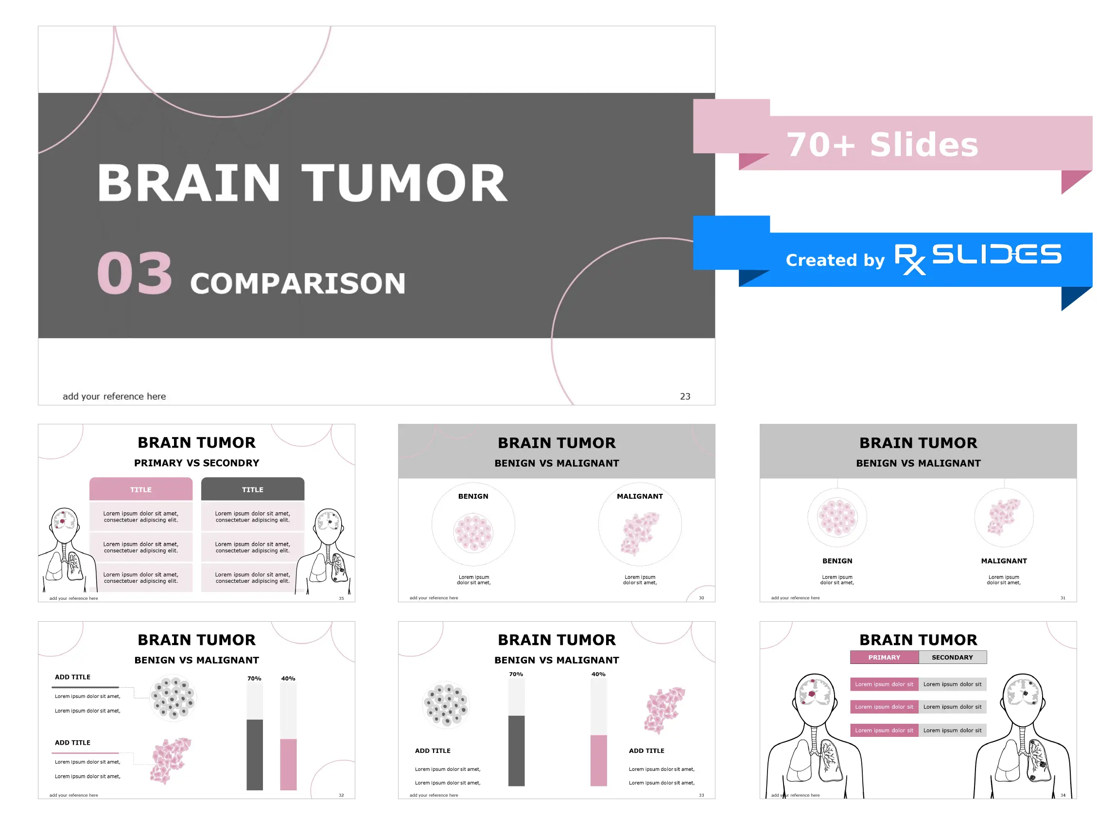 Download Brain Tumor PowerPoint Template| RxSlides